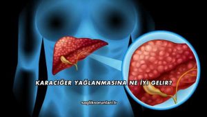 Karaciğer Yağlanmasına Ne İyi Gelir? - Sağlık Sorunları